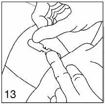 Jadelle 2 x 75 mg implantes